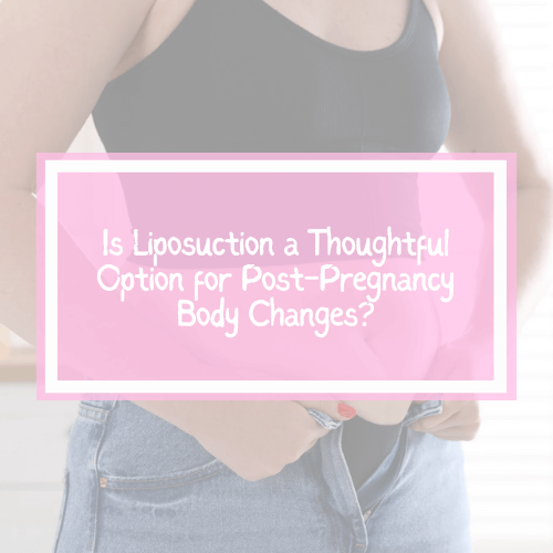 Post-Pregnancy Body - Is Liposuction a Thoughtful Option?